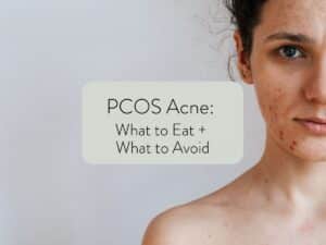 PCOS Acne Diet: What To Eat + Avoid (A Dietitian's Guide) - The PCOS ...